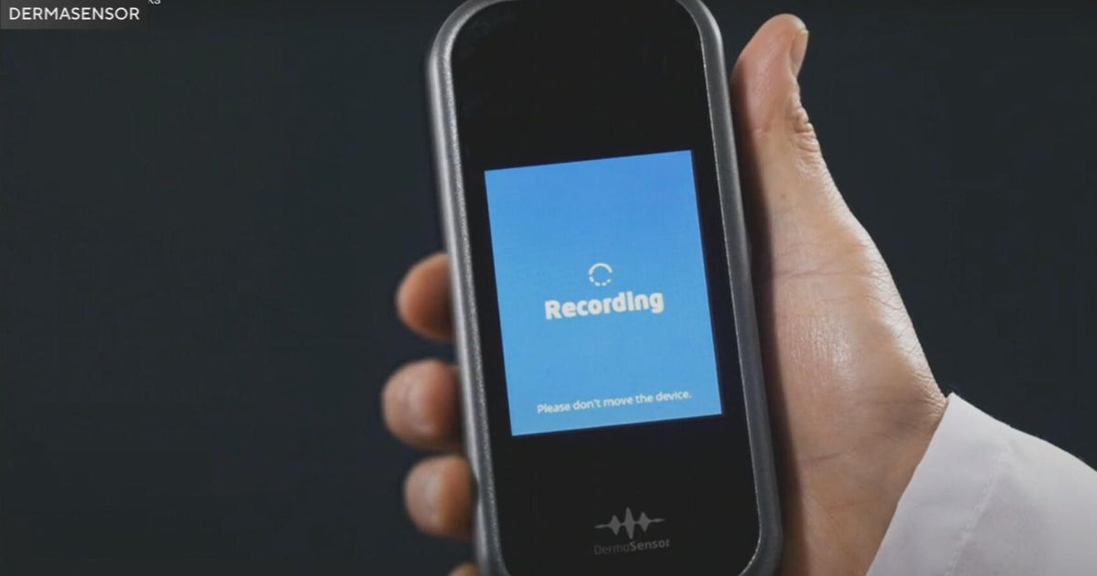 New AI-powered device DermaSensor could help detect skin cancer - CBS ...