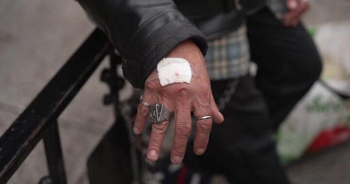 Man stabbed in hand at Bronx station hopes Gov. Kathy Hochul's subway ...