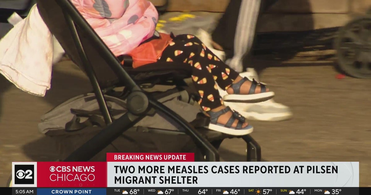 Two more measles cases reported at Pilsen migrant shelter - CBS Chicago