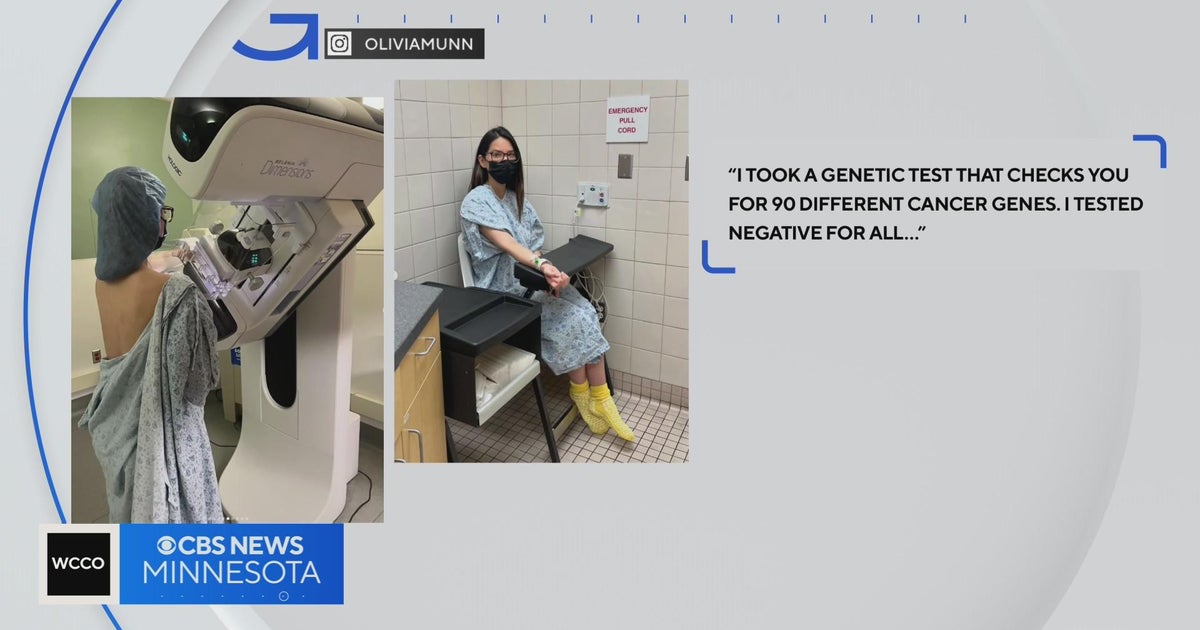 How do breast cancer risk assessment tests work? - CBS Minnesota