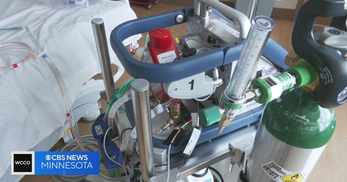 Regions Hospital receives lifesaving ECMO machine - CBS Minnesota