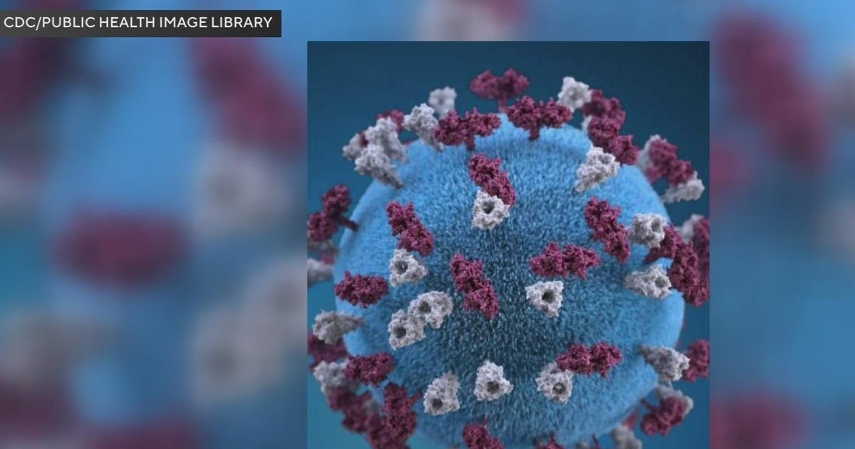 First confirmed measles case in Cook County suburbs - CBS Chicago
