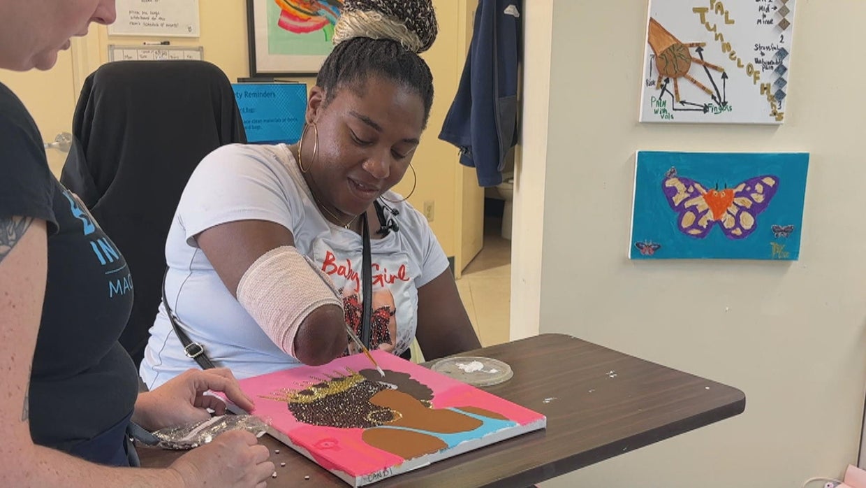 Philadelphia woman who lost limbs after COVID-19 battle overcomes the ...