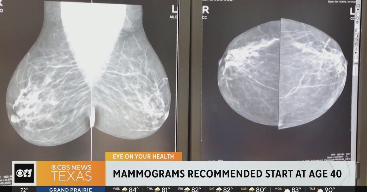 Mammograms now recommended starting at age 40 - CBS Texas