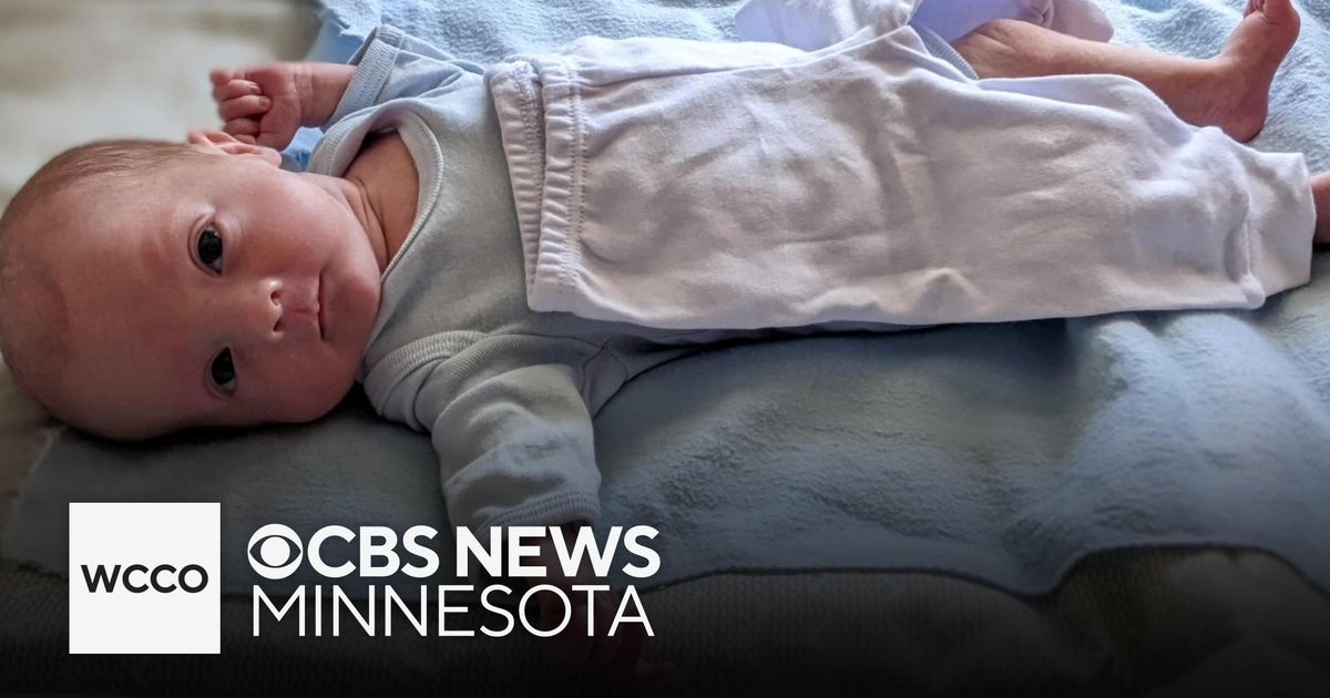 Minnesota couple struggling to bring newborn home from Brazil - CBS ...