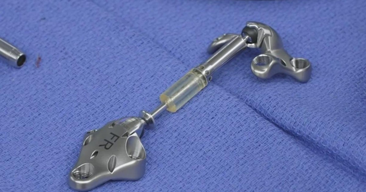 A look at cutting-edge knee tech at UC Davis Health ...Middle East