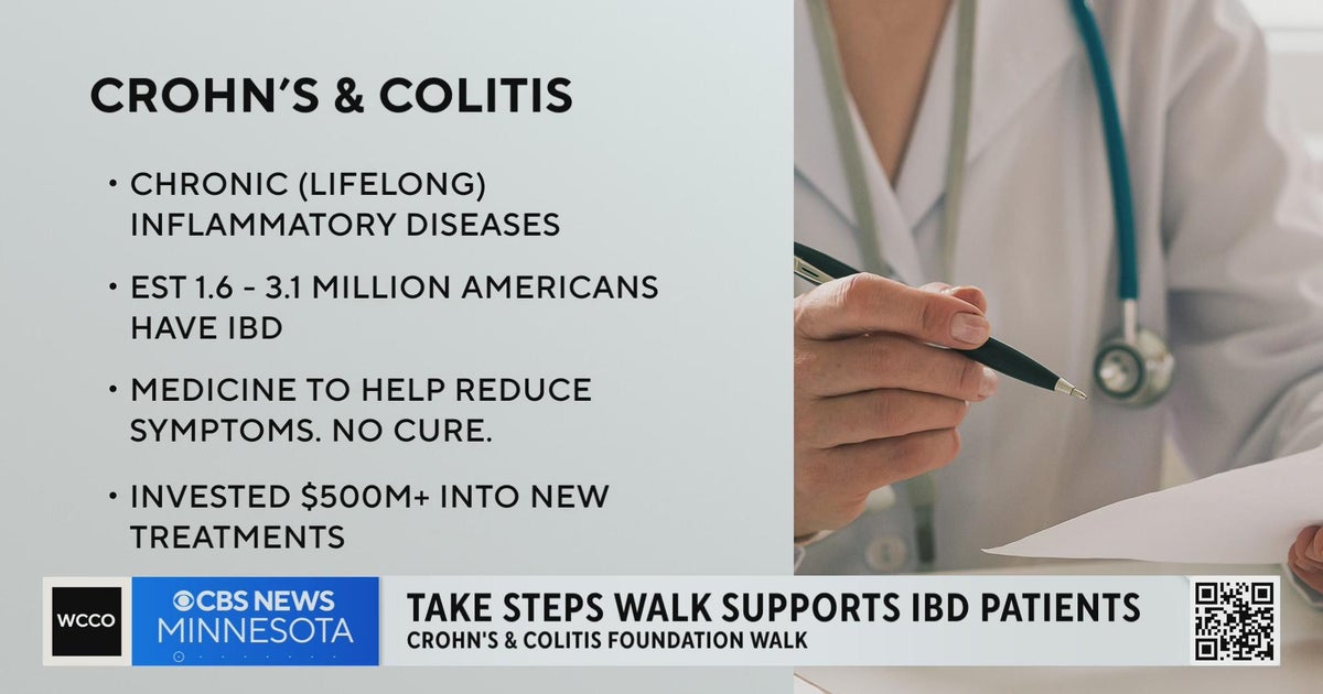 “Take Steps” walk supports Crohn’s and Colitis Foundation - CBS Minnesota