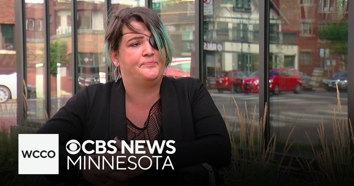 Journalist whom police shot with rubber bullet during 2020 unrest now ...