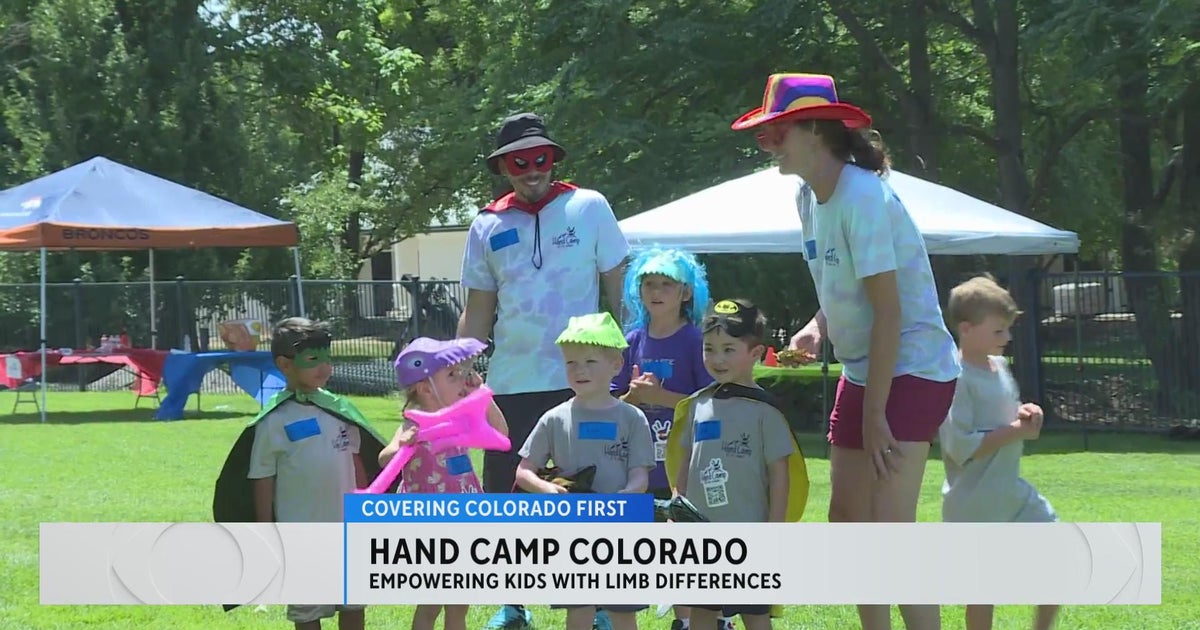 Hand Camp Colorado helps empower children wtih limb differences - CBS ...