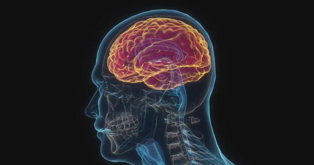 Researchers publish study to record signs of concussion in slap ...
