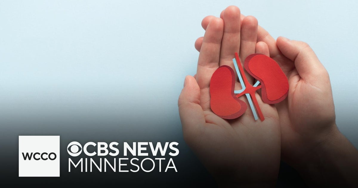 Allianz Field hosts National Kidney Foundation fundraiser - CBS Minnesota