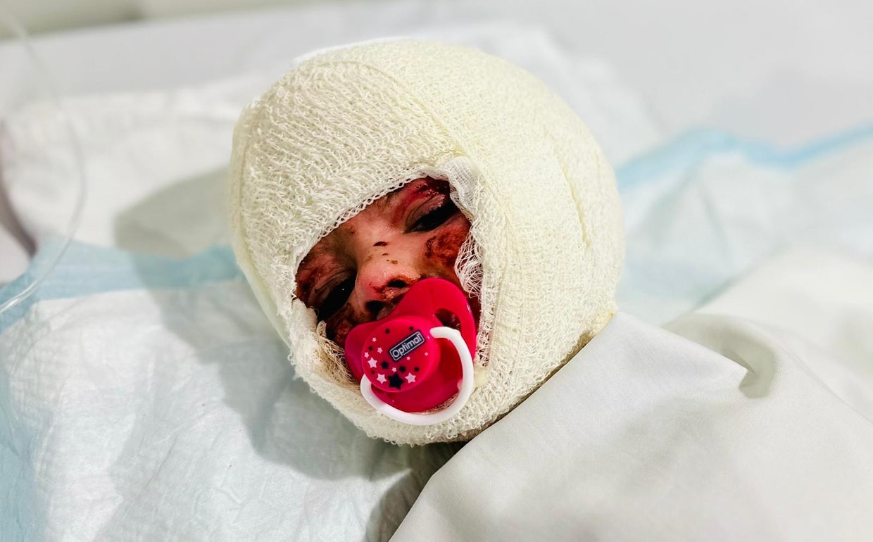 Israel's proxy war with Iran leaves young children in Gaza and Lebanon ...