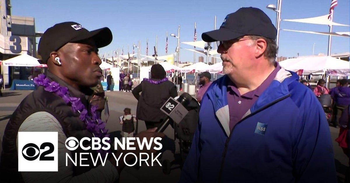 Lupus research focusing on earlier diagnoses, HSS chief doctor says ...