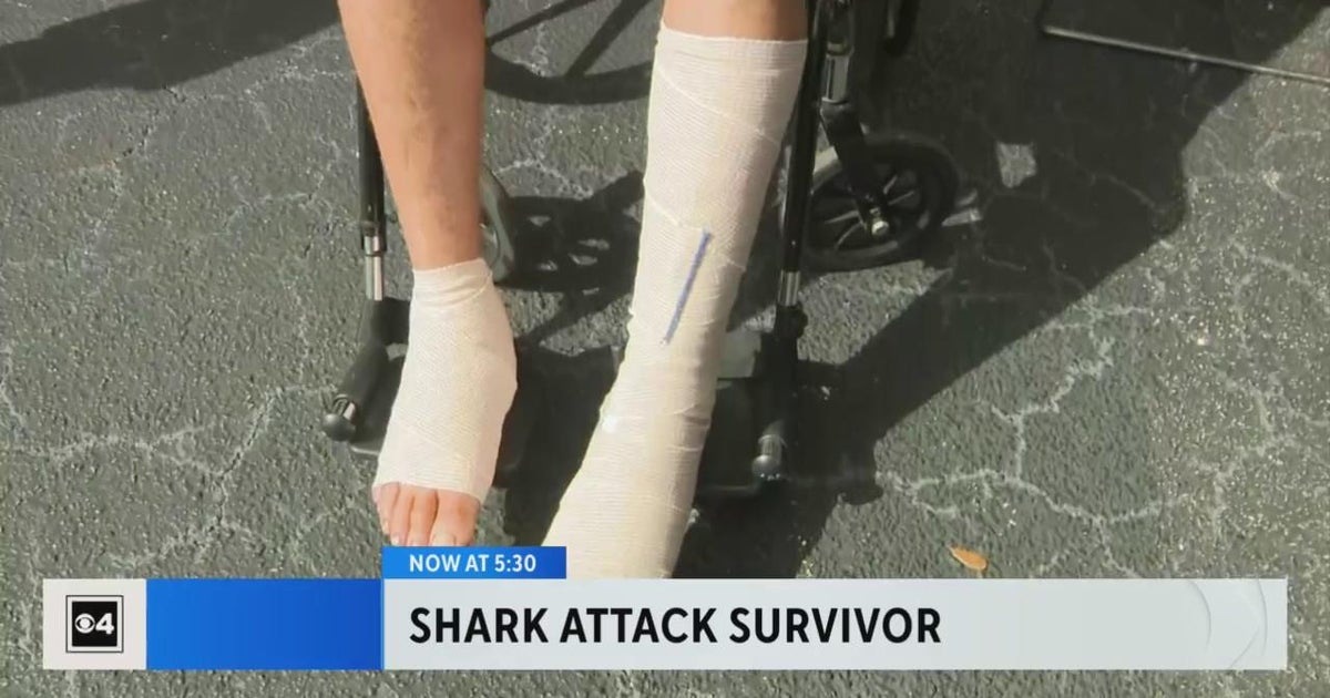 Florida shark attack survivor speaks out after being bitten again 10 ...