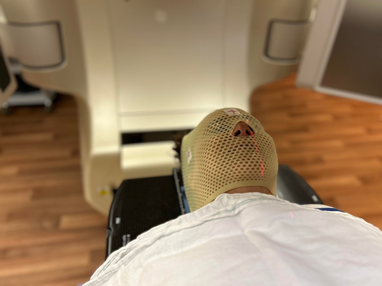 New treatments offer hope for older patients with a deadly cancer ...