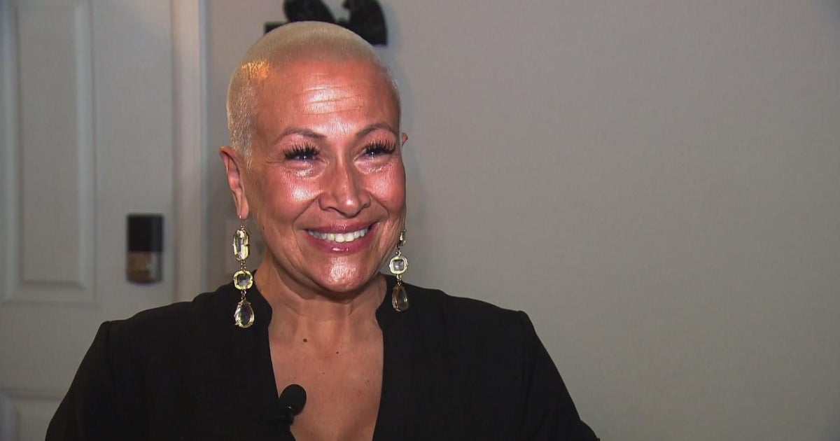 Colorado DUI survivor tells story to warn others from getting behind ...