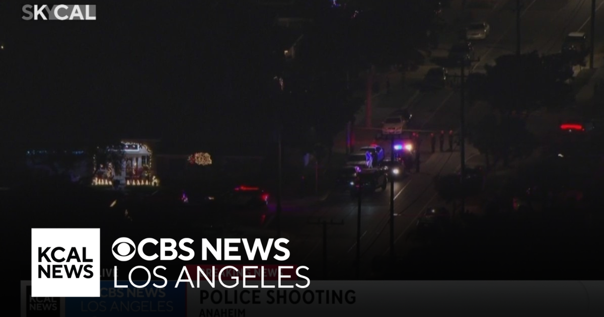 Man hospitalized after police shooting in Anaheim - CBS Los Angeles