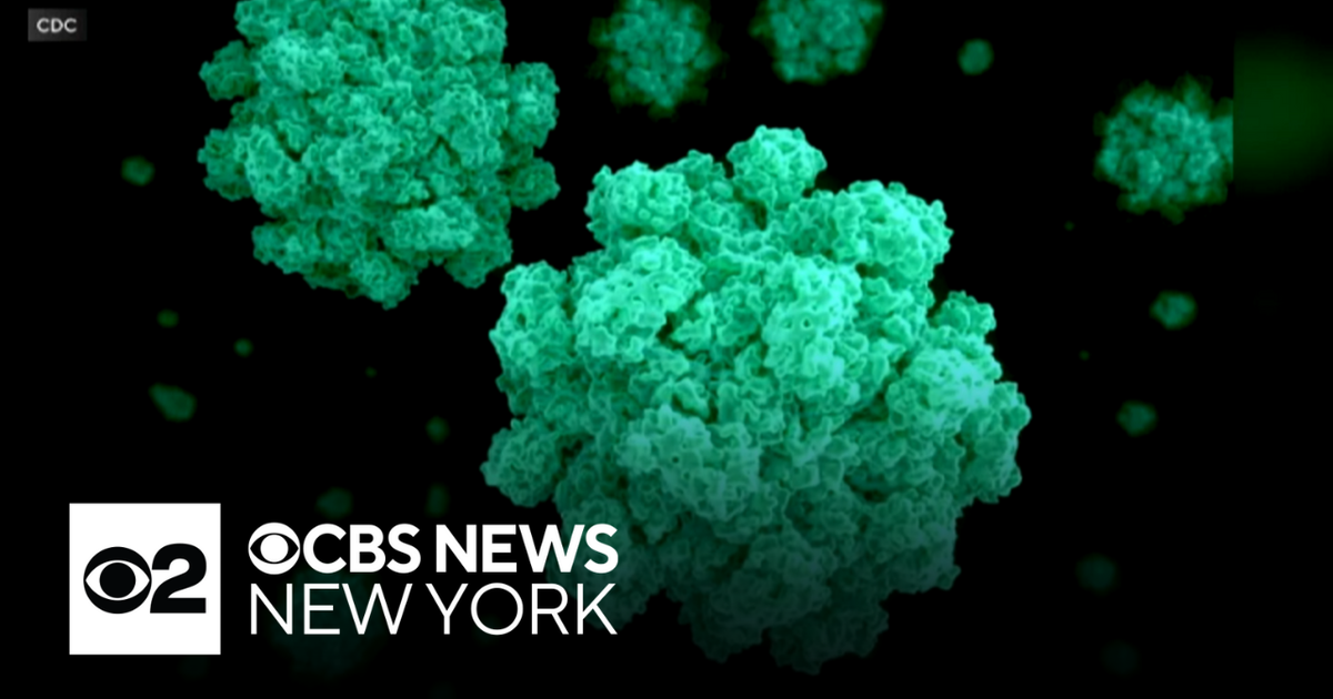 Norovirus cases on the rise - CBS New York
