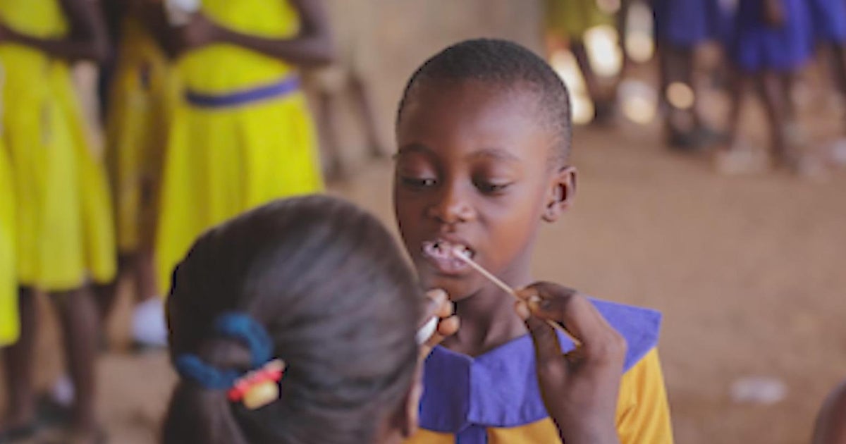 From Ghana to Garland: North Texas dentist's global impact through ...