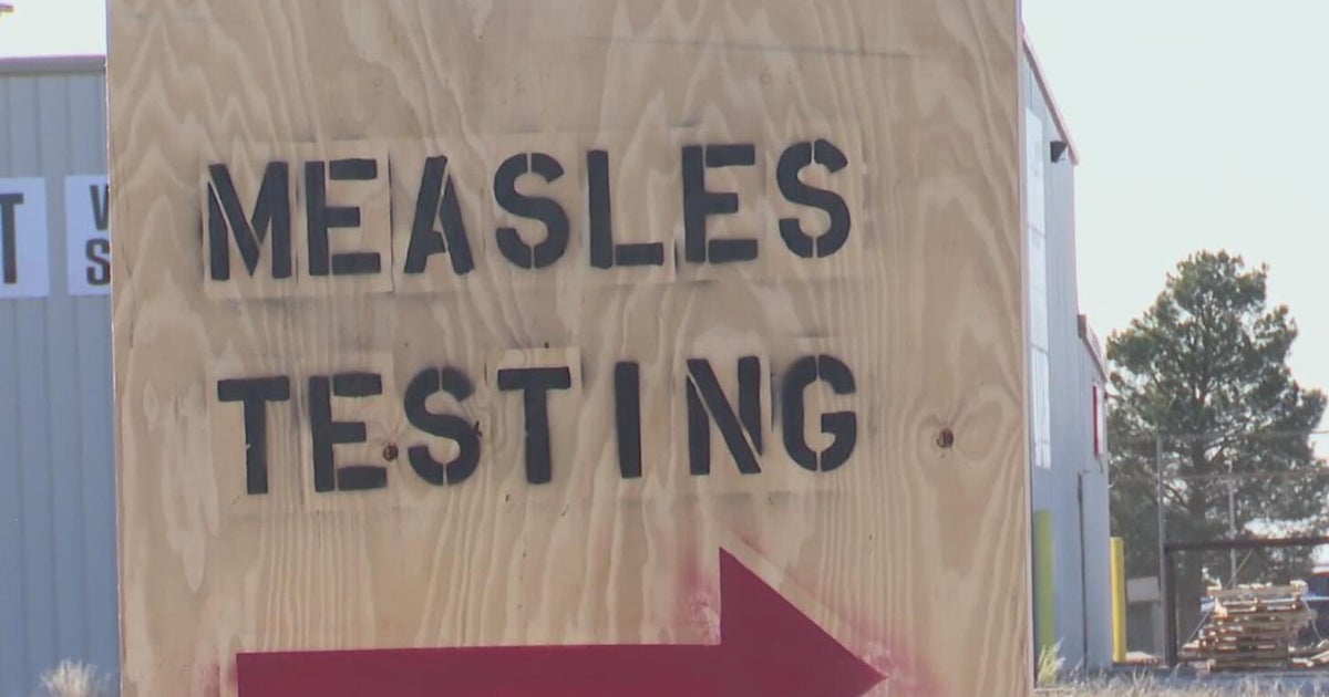 Expert answers measles FAQs - CBS Texas