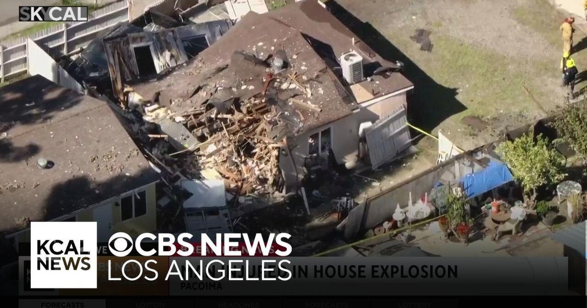 Pacoima house fire leaves man in critical condition and dogs displaced ...