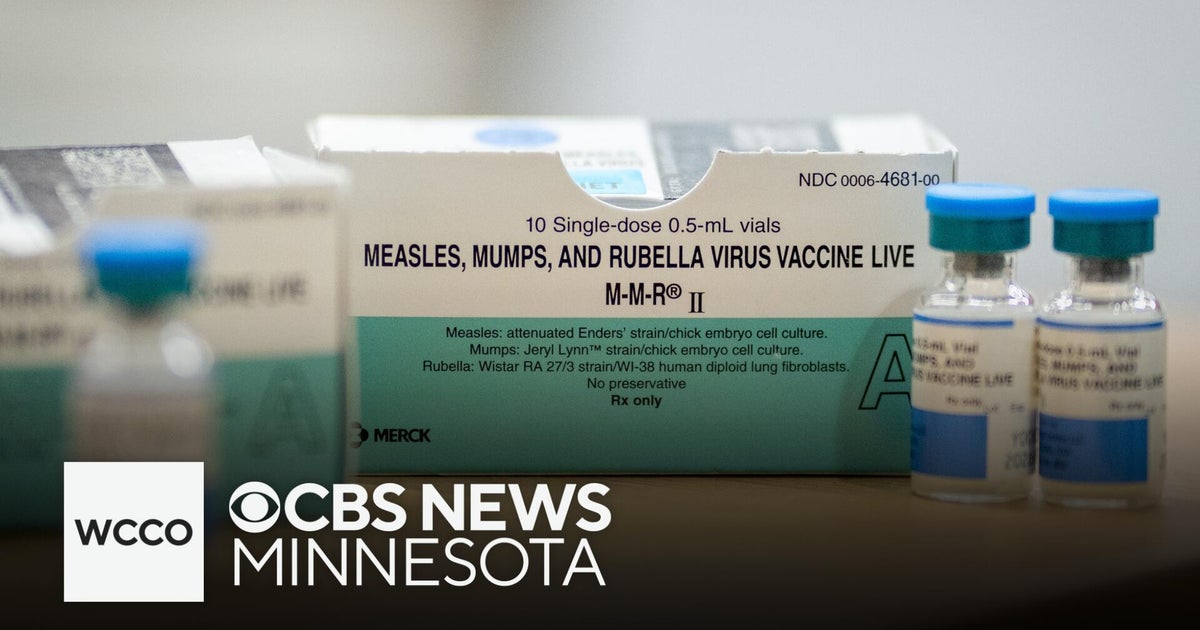 Health officials report first case of measles in Minnesota - CBS Minnesota