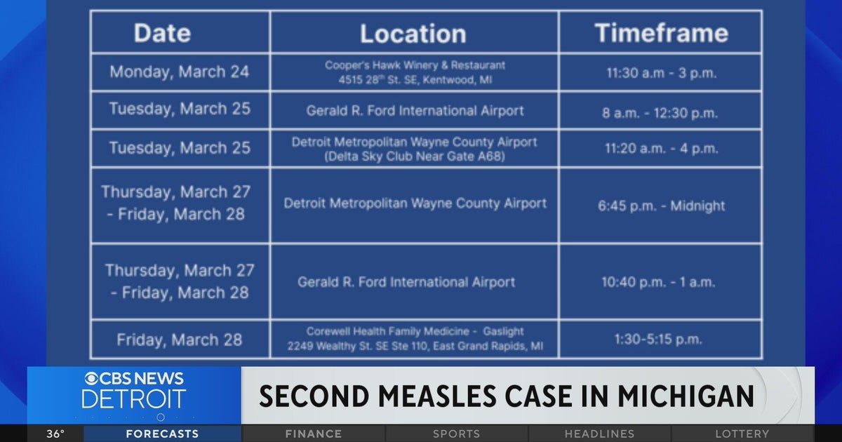 Second measles case confirmed in Michigan - CBS Detroit