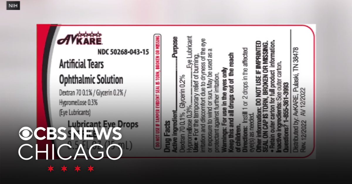 Avkare eyedrops recalled for "manufacturing deviations" - CBS Chicago