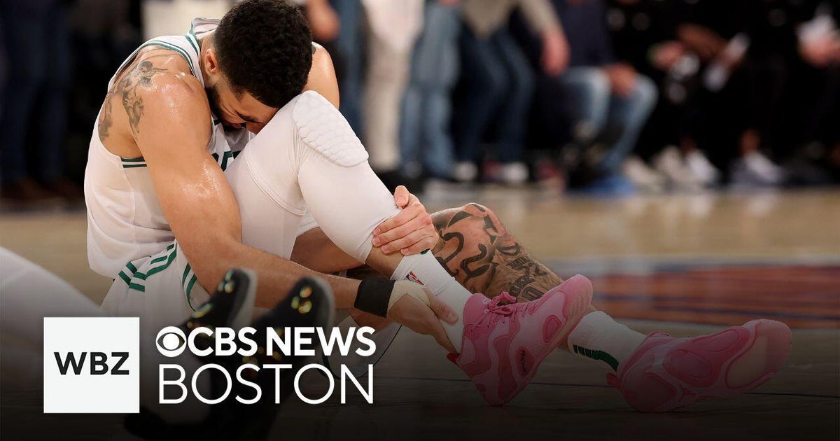 How do NBA players perform after an Achilles rupture? A doctor studied ...