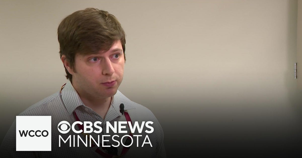 What are birthmarks? And how do we get them? - CBS Minnesota