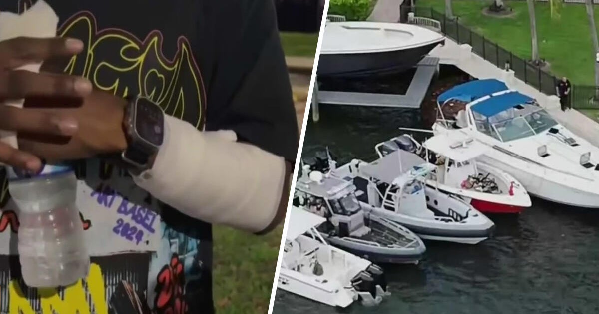 Father burned in Fort Lauderdale boat explosion speaks out - CBS Miami