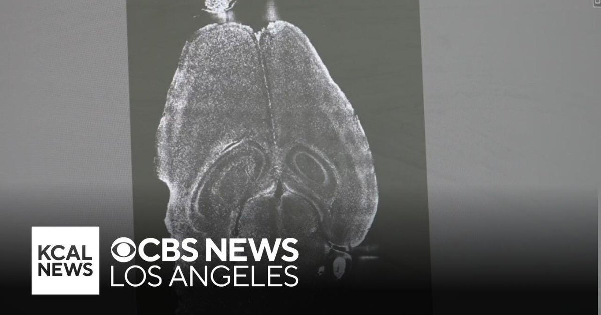 UCLA Brain Mapping in Westwood | KCAL Cares - CBS Los Angeles