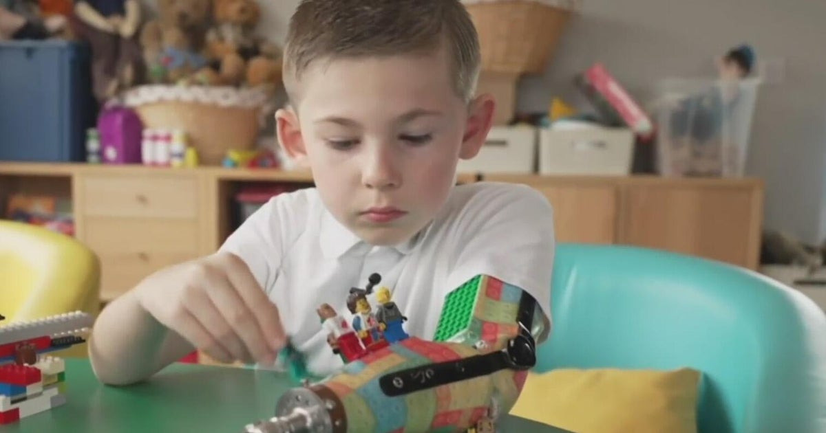 8-year-old gets prosthetic arm made out of Lego - CBS Texas
