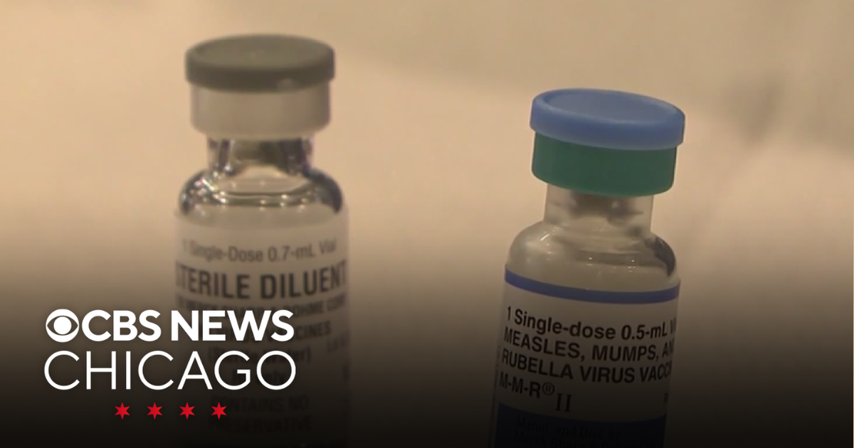 2025 a record year for measles cases, data shows - CBS Chicago