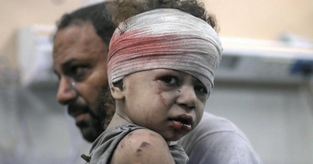 The impact of the war in Gaza on children - CBS News