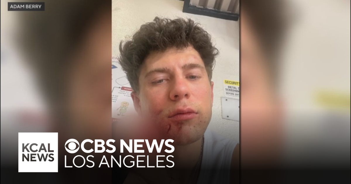 Man beaten during road rage attack in Los Angeles, police still ...