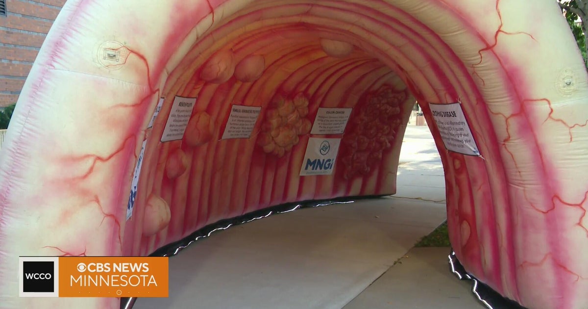 The giant colon is back. Here's why. - CBS Minnesota