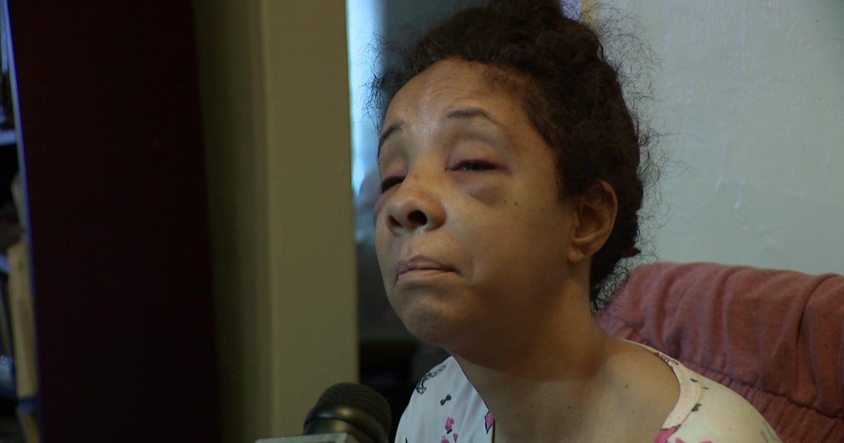Bronx woman who survived brutal, unprovoked attack says "I really ...