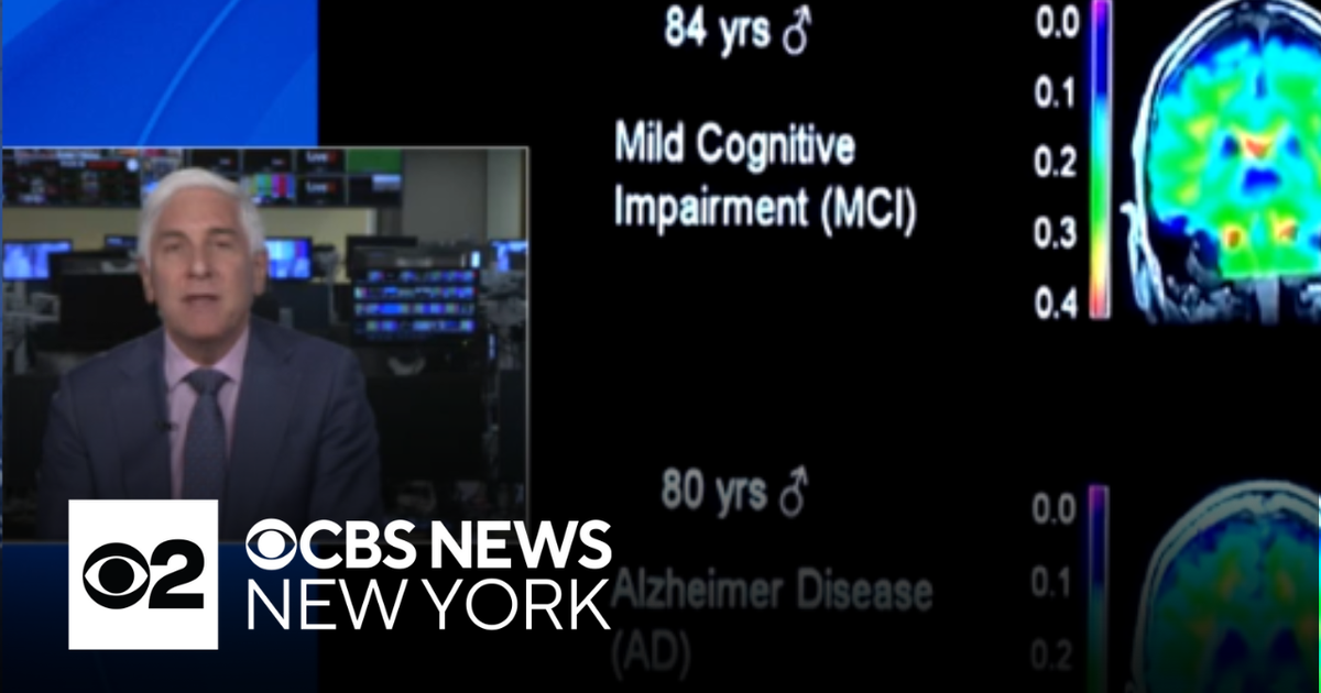 Dr. Jon LaPook talks about the latest developments in the fight against ...