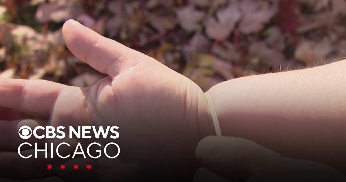 Snap a rubber band to deal with stressful thoughts - CBS Chicago