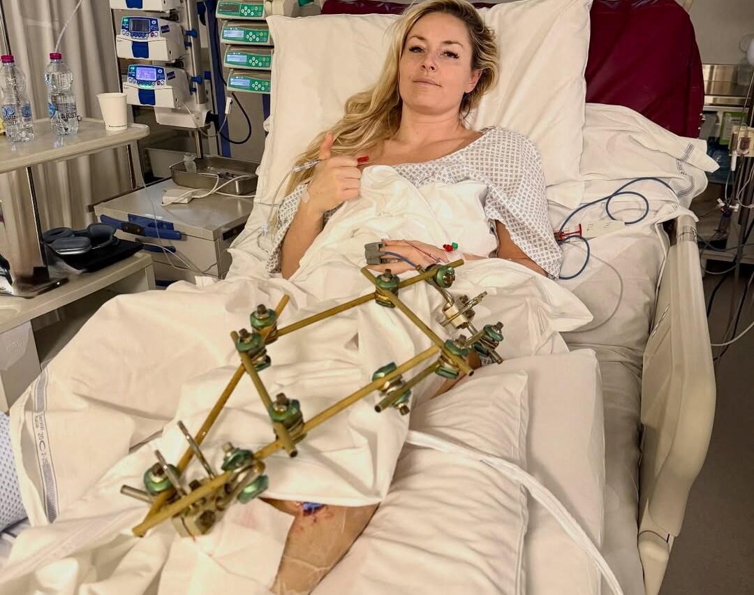 Lindsey Vonn says surgery saved her leg from amputation after Olympics ...