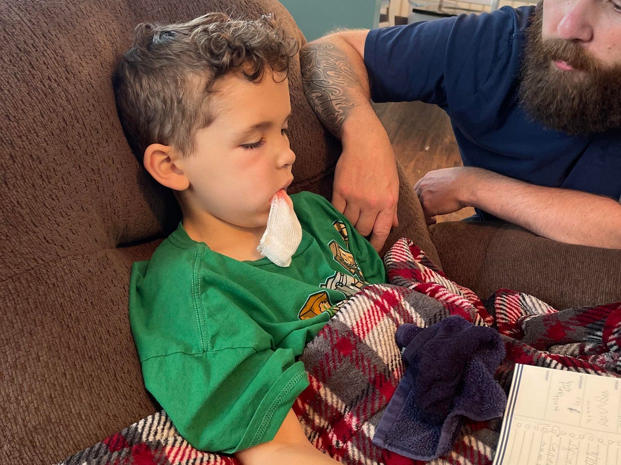 More kids are in ERs for tooth pain. Budget cuts and fluoride fights ...