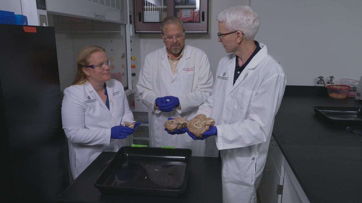 Dog brains could hold key information for longer, healthier human lives ...